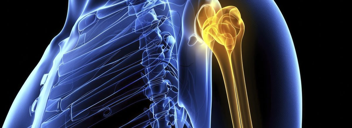 Signs You Need Shoulder Surgery