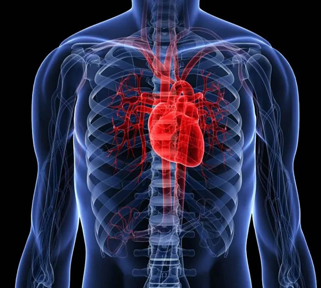 Timely Medical Coronary Angiogram