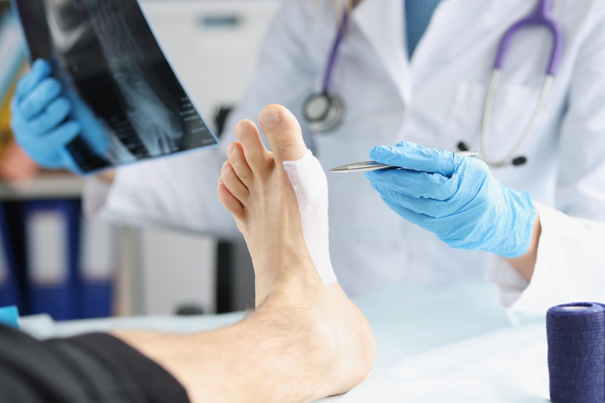 Foot Surgery: Types, Procedures & Recovery Time